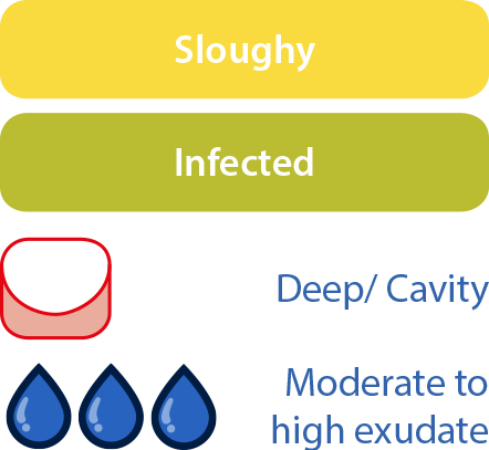 SORBSAN SILVER PACKING – Sorbsan